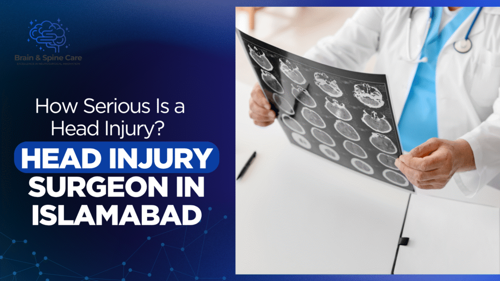 How Serious Is a Head Injury? Head Injury Surgeon in Islamabad ...
