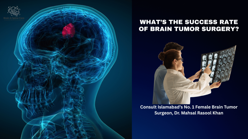 What's the Success Rate of Brain Tumor Surgery? - Elitesurgerydoc